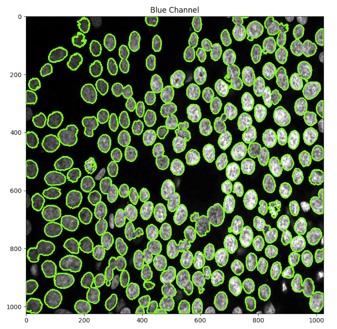 How arivis Cloud Can Support in Cancer Research