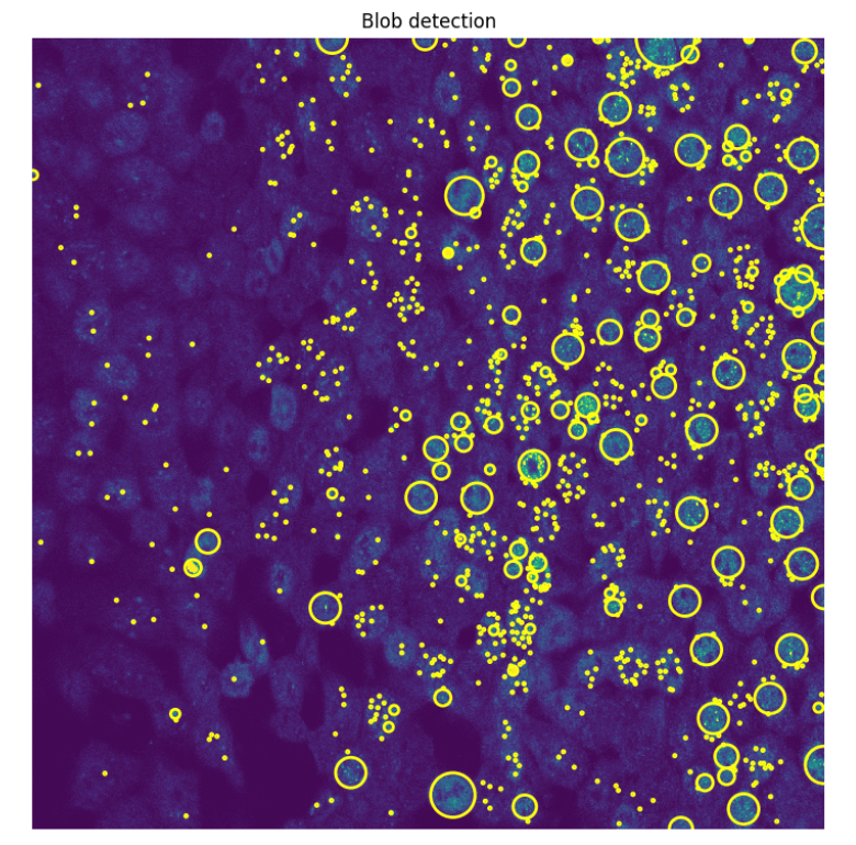 How arivis Cloud Can Support in Cancer Research