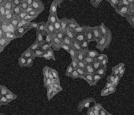 Denoising images using kuwahara filter