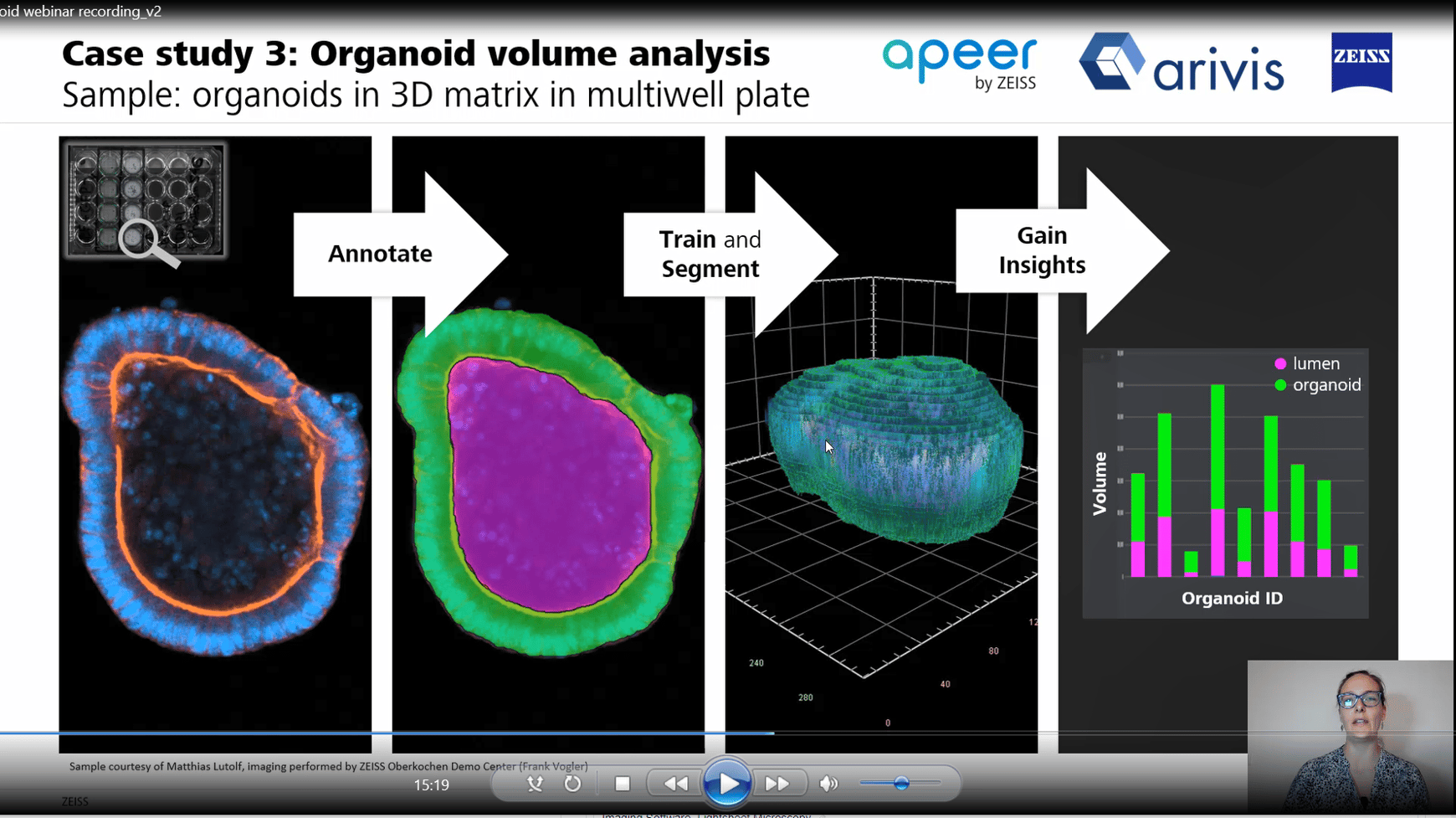 Organoid image analysis powered with AI